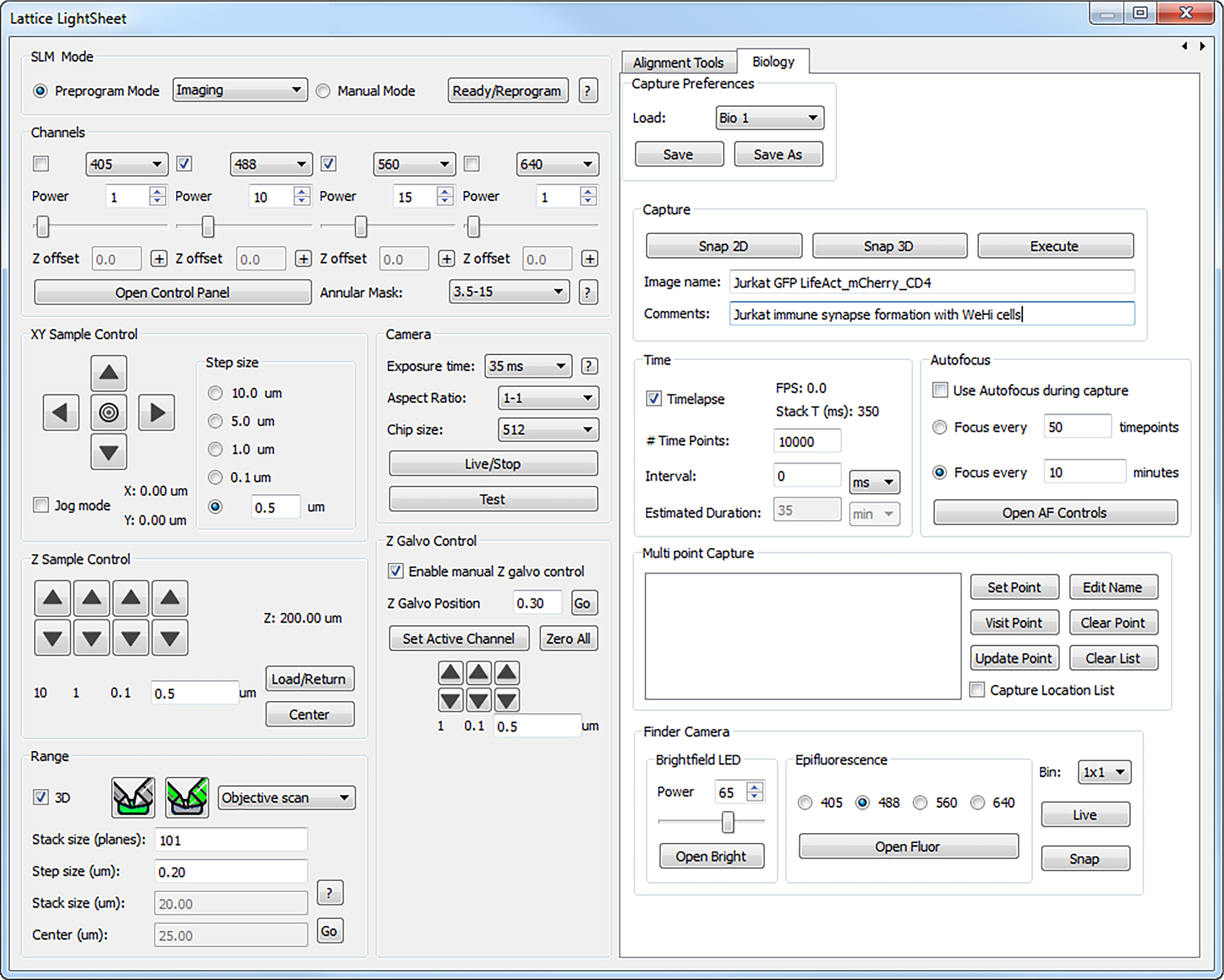 Lattice LightSheet - 3i