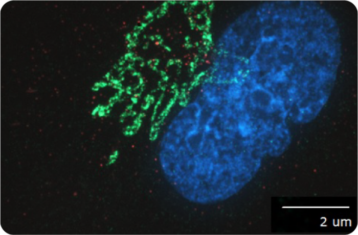 Spinning Disk Confocal - 3i