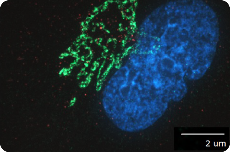 Spinning Disk Confocal - 3i