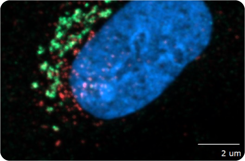 Spinning Disk Confocal - 3i