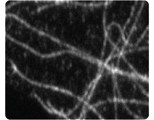 Spinning Disk Confocal - 3i