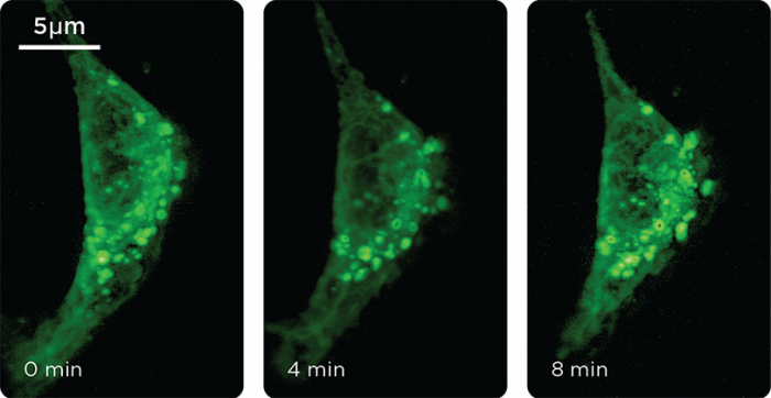 Lattice LightSheet - 3i