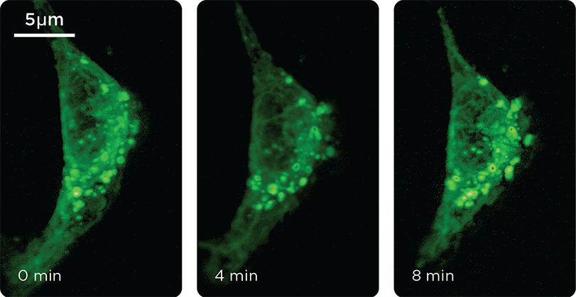 Lattice LightSheet - 3i
