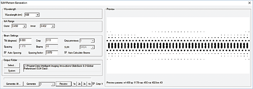 Lattice LightSheet - 3i