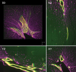 AxL Cleared Tissue LightSheet - 3i