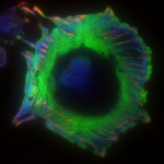 Total Internal Reflection Fluorescence (TIRF) Microscopy - 3i